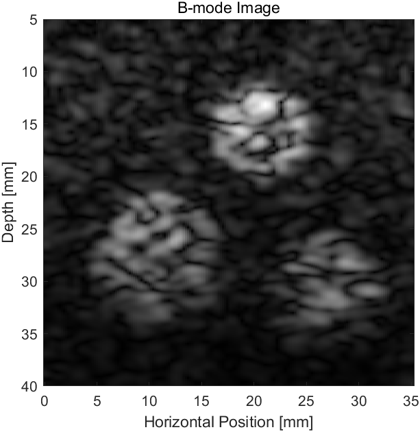 B模式超声成像仿真(MATLAB k-Wave仿真)_matlab实现超声b扫描-CSDN博客