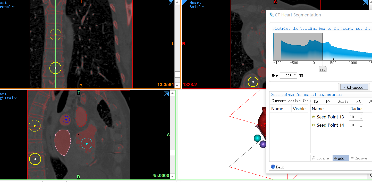 【Mimics】基于心脏ct影像重建3d模型 孔洞修复平滑处理 及 合并导出_ct数据 3d建模-CSDN博客