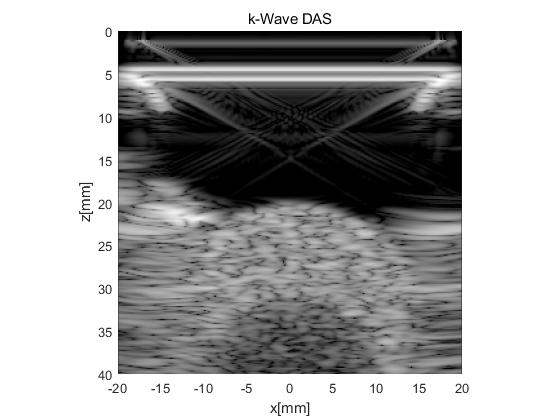 人体组织平面波超声成像仿真(MATLAB k-Wave仿真)_wave3000超声仿真-CSDN博客