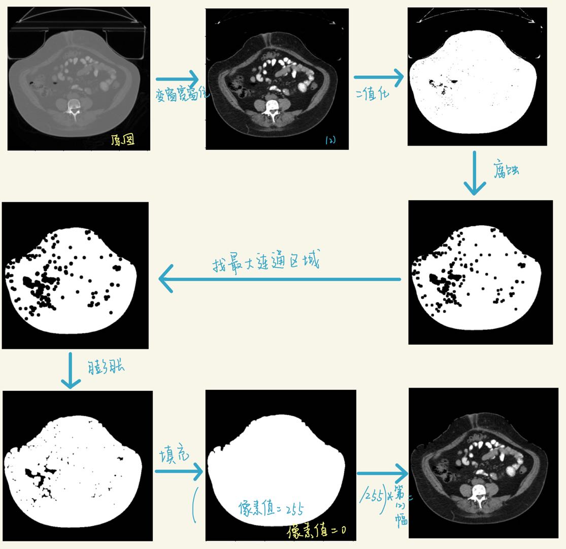 DICOM的理解与学习2_ct图像如何去除床印记-CSDN博客
