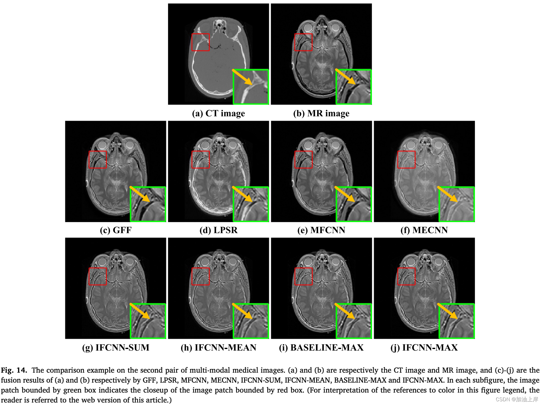 IFCNN: A general image fusion framework based on convolutional ...