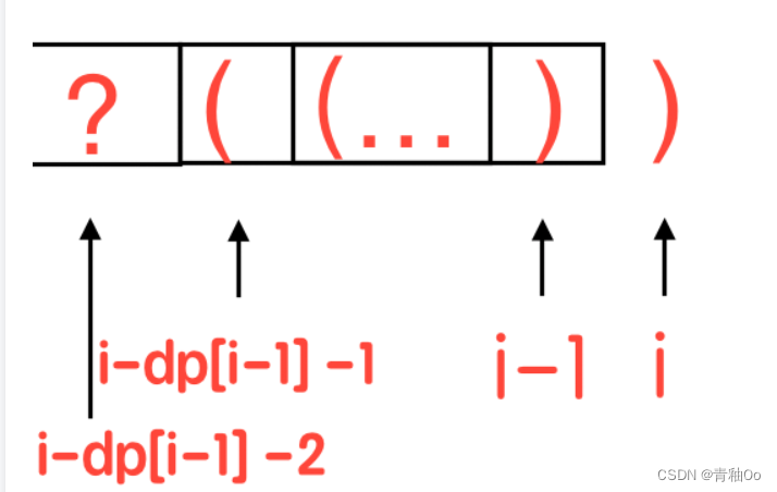 最长有效括号 Csdn博客 