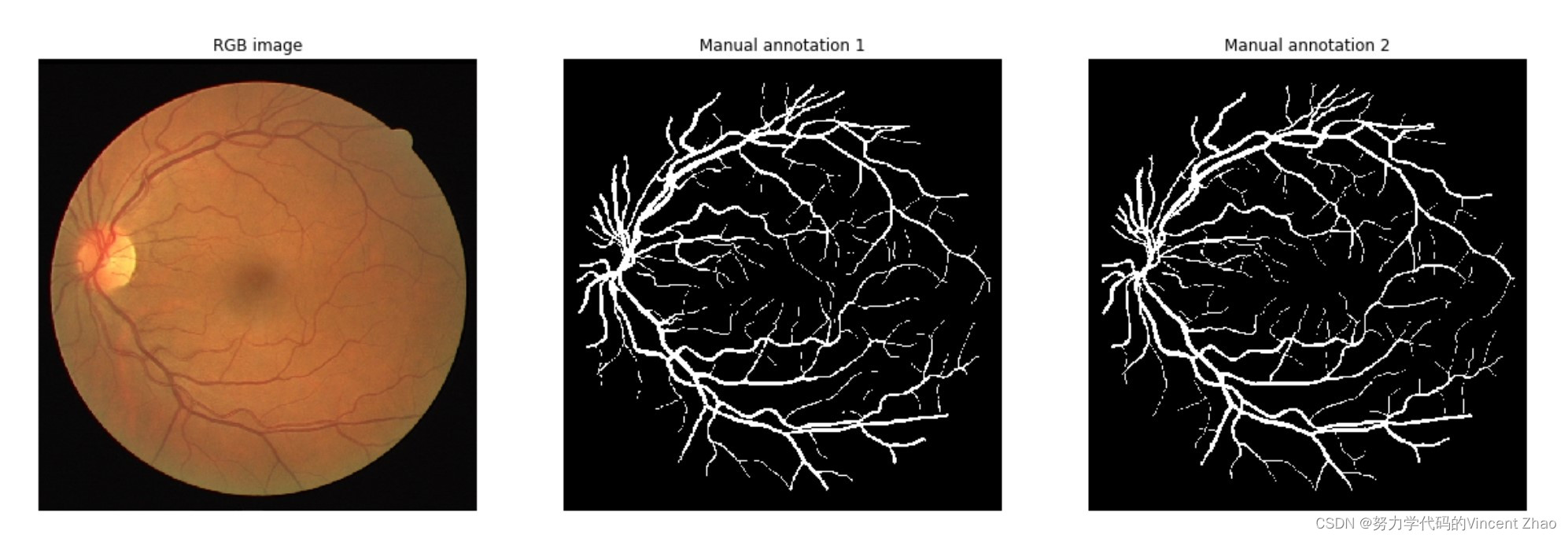 深度学习图像语义分割数据集的使用范围对比(关注几何形状)_stare数据集-CSDN博客