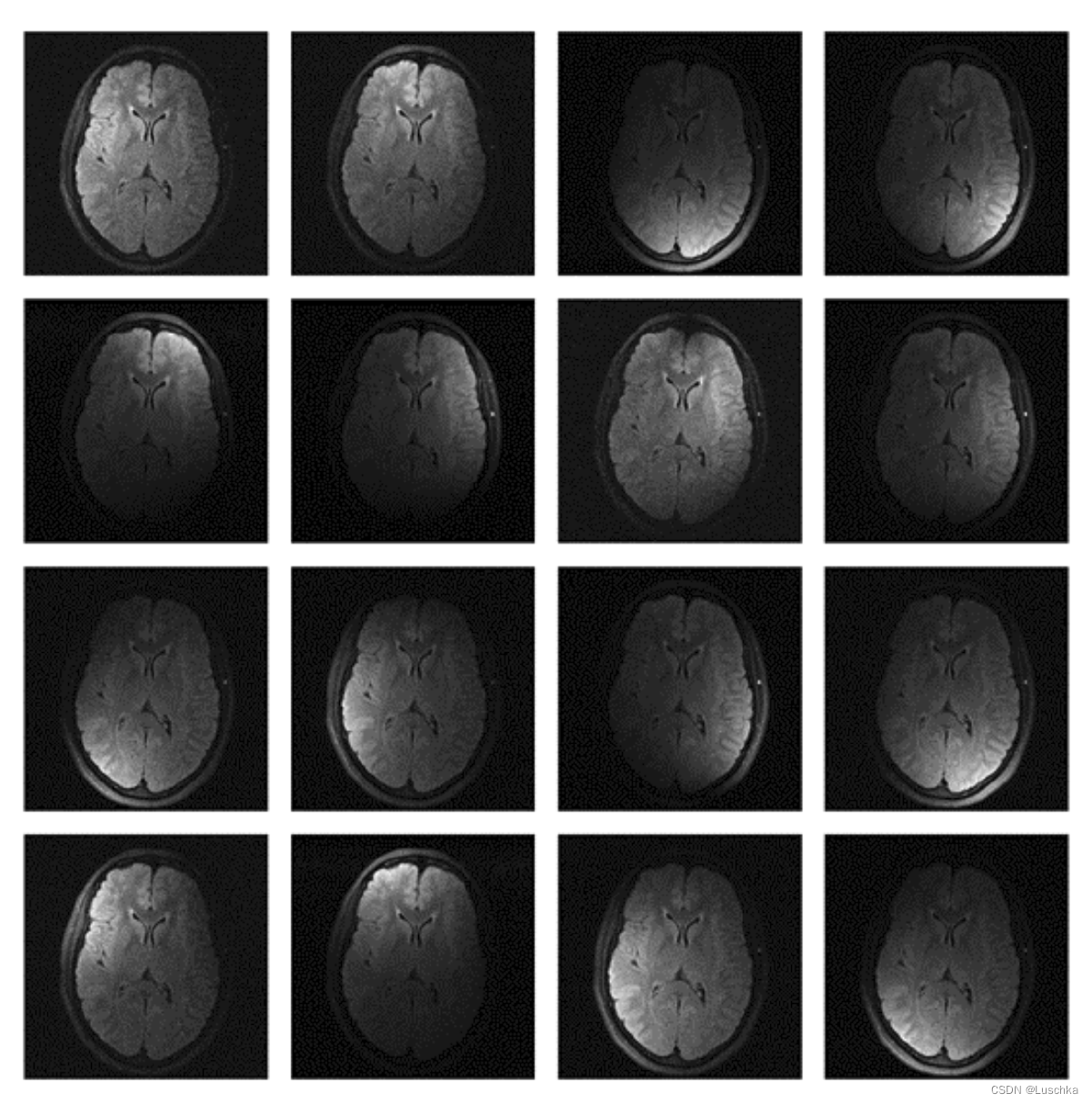 并行磁共振成像——SENSE 敏感度编码成像_mri并行-CSDN博客