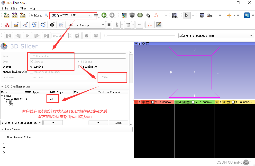 3D Slicer学习记录（0）--利用OpenIGTLink实现数据发送接收-CSDN博客