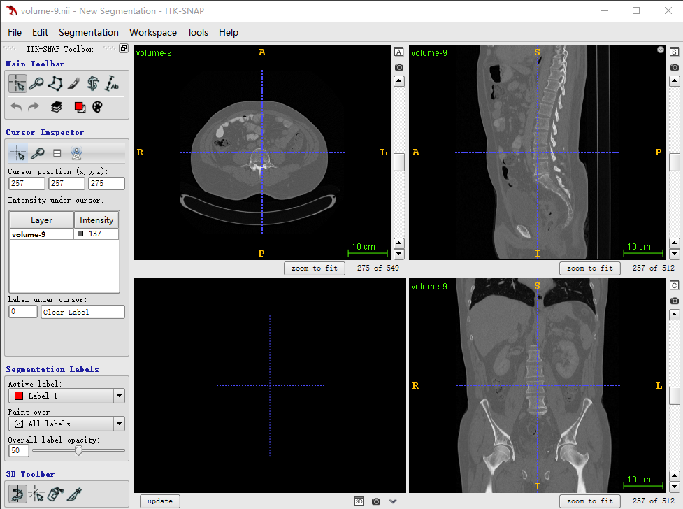 ITK-SNAP使用笔记_itk-snap收获-CSDN博客
