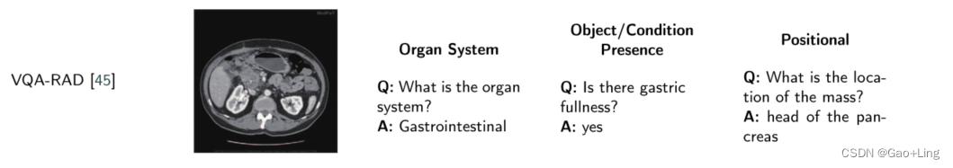 医学视VQA——综述_vqa-rad-CSDN博客