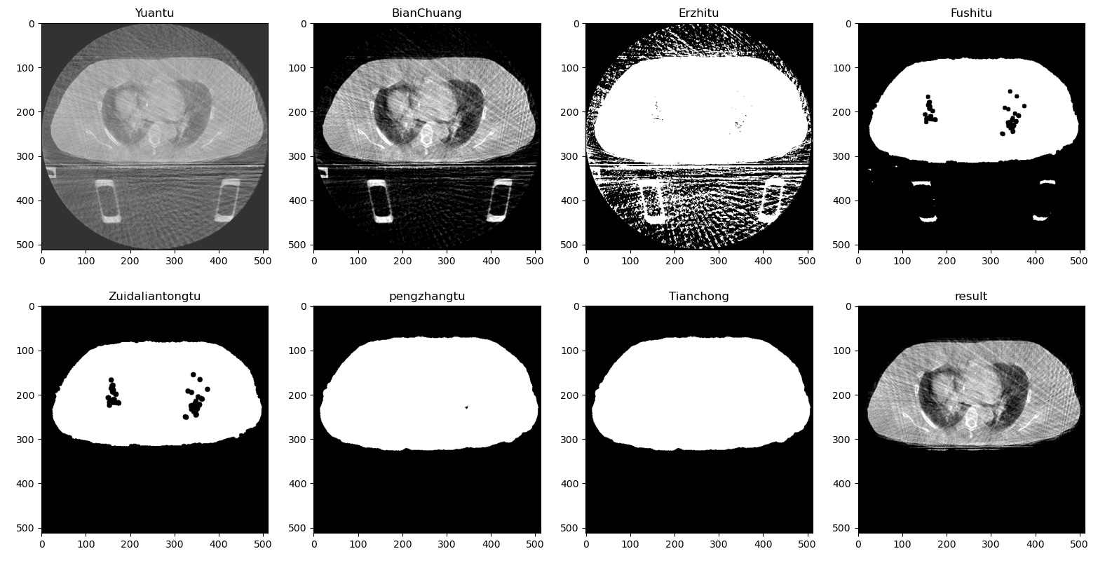DICOM的理解与学习2_ct图像如何去除床印记-CSDN博客