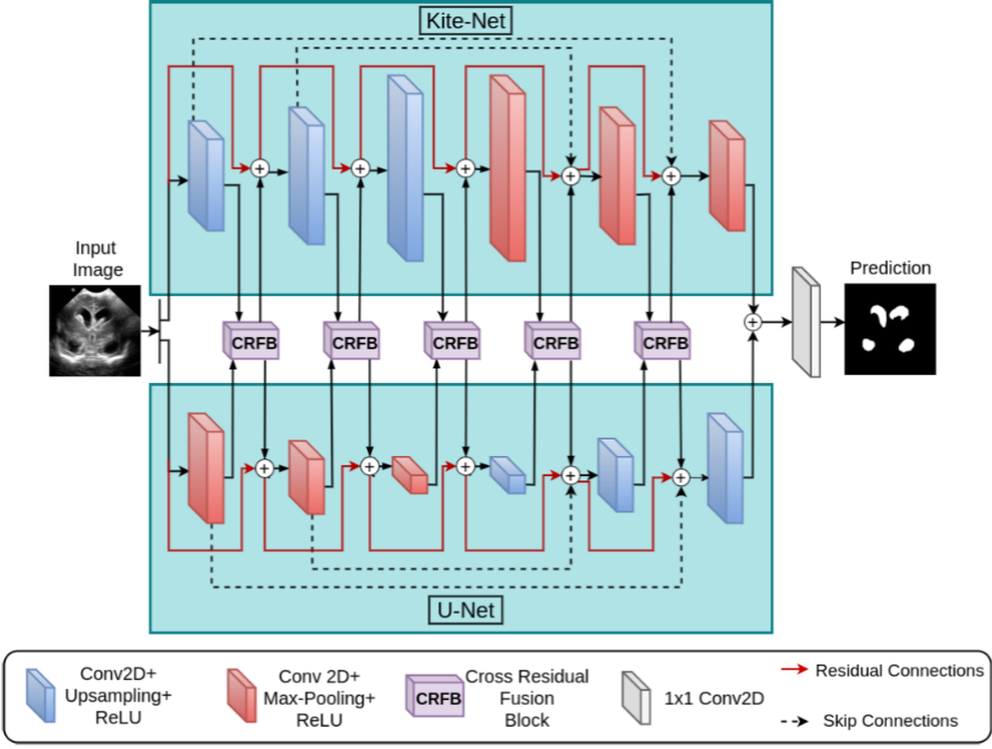 KiU-Net: Overcomplete Convolutional Architectures for Biomedical Image and Volumetric ...