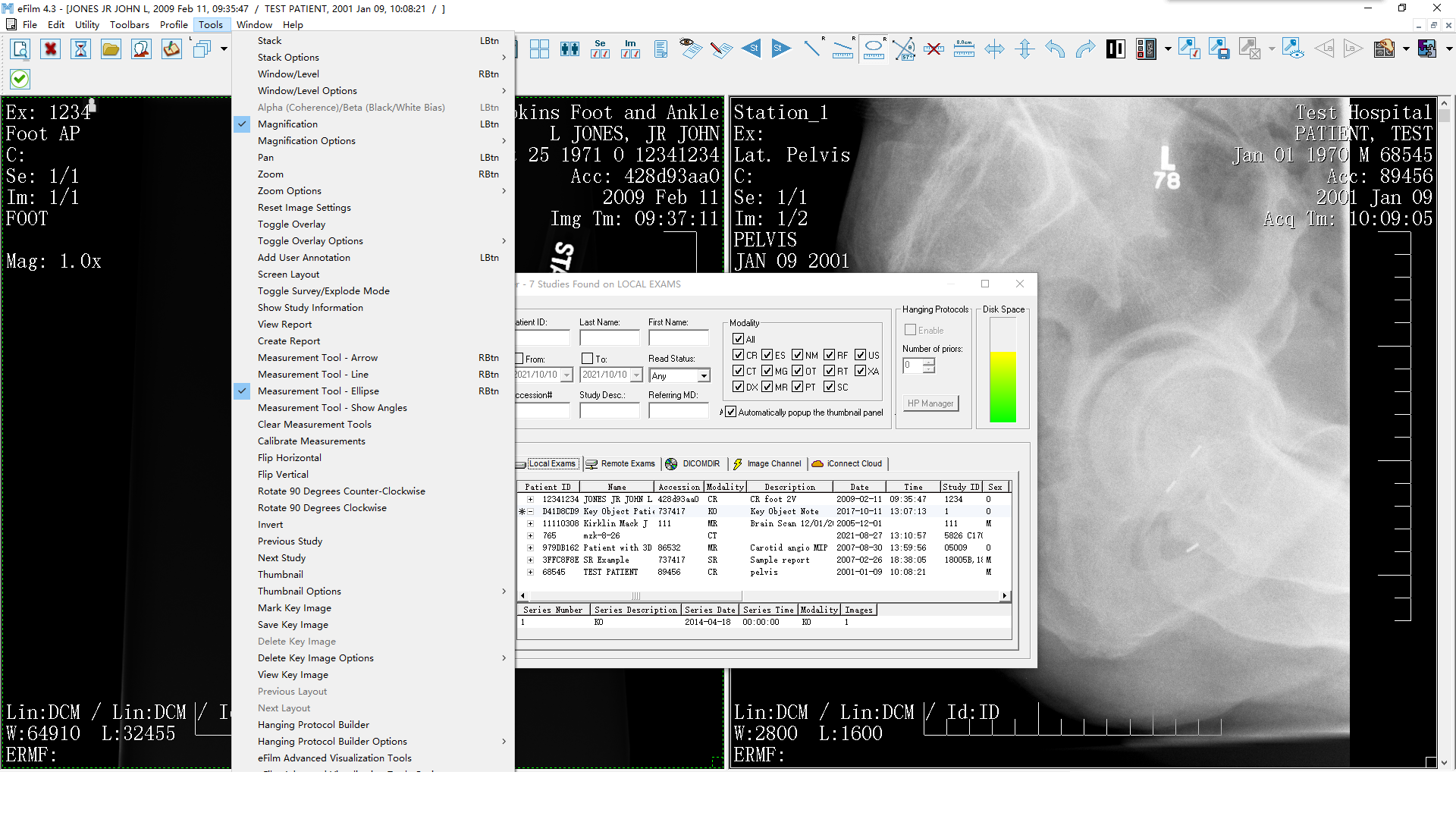 eFilm Workstation dicom 4.3 vs radiant dicom-CSDN博客