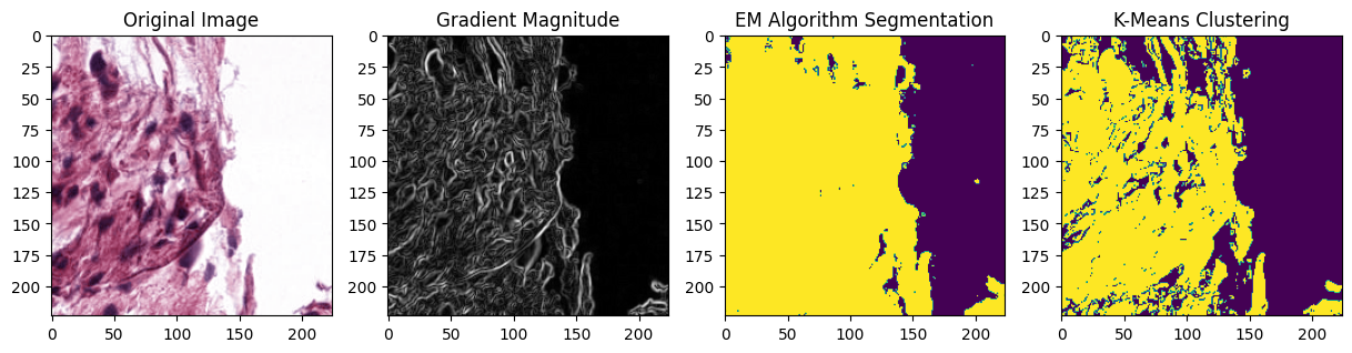 【ML\CV\segmentation】EM算法&CRF模型在图像分割领域中的应用 || 学习笔记_em算法在图像处理-CSDN博客