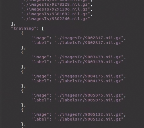 在ubuntu/windows中安装nnUNet并训练自己的数据_windows nnunet-CSDN博客