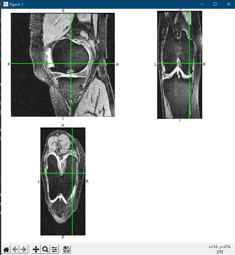 python打开nii.gz，可查看像素值_nii.gz图像怎么打开-CSDN博客