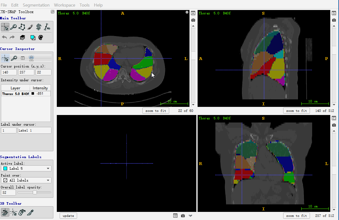 【医学影像数据处理】nii、npz、npy、dcm、mhd 的数据格式互转，及多目标分割处理汇总_convert them to numpy ...