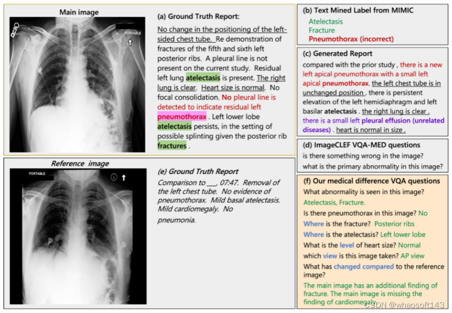 MIMIC-Diff-VQA_mimic cxr数据集可以做什么任务-CSDN博客