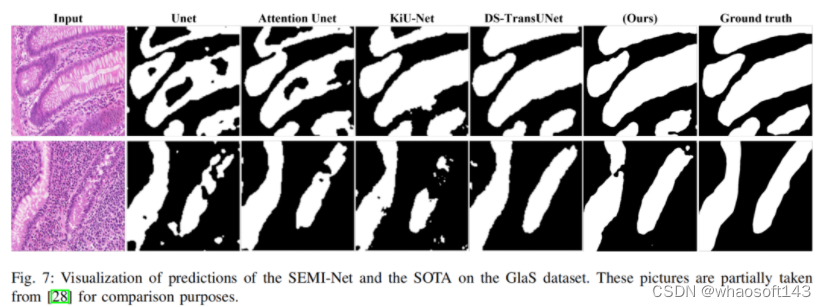 UNet-Transformer_transformer unet-CSDN博客