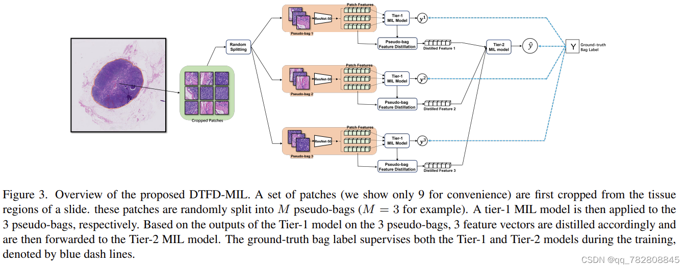 （WSI分类）WSI分类文献小综述_scaling vision transformers to gigapixel images vi-CSDN博客