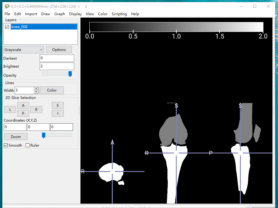 nnUNet一个医学图像分割神仙算法-CSDN博客