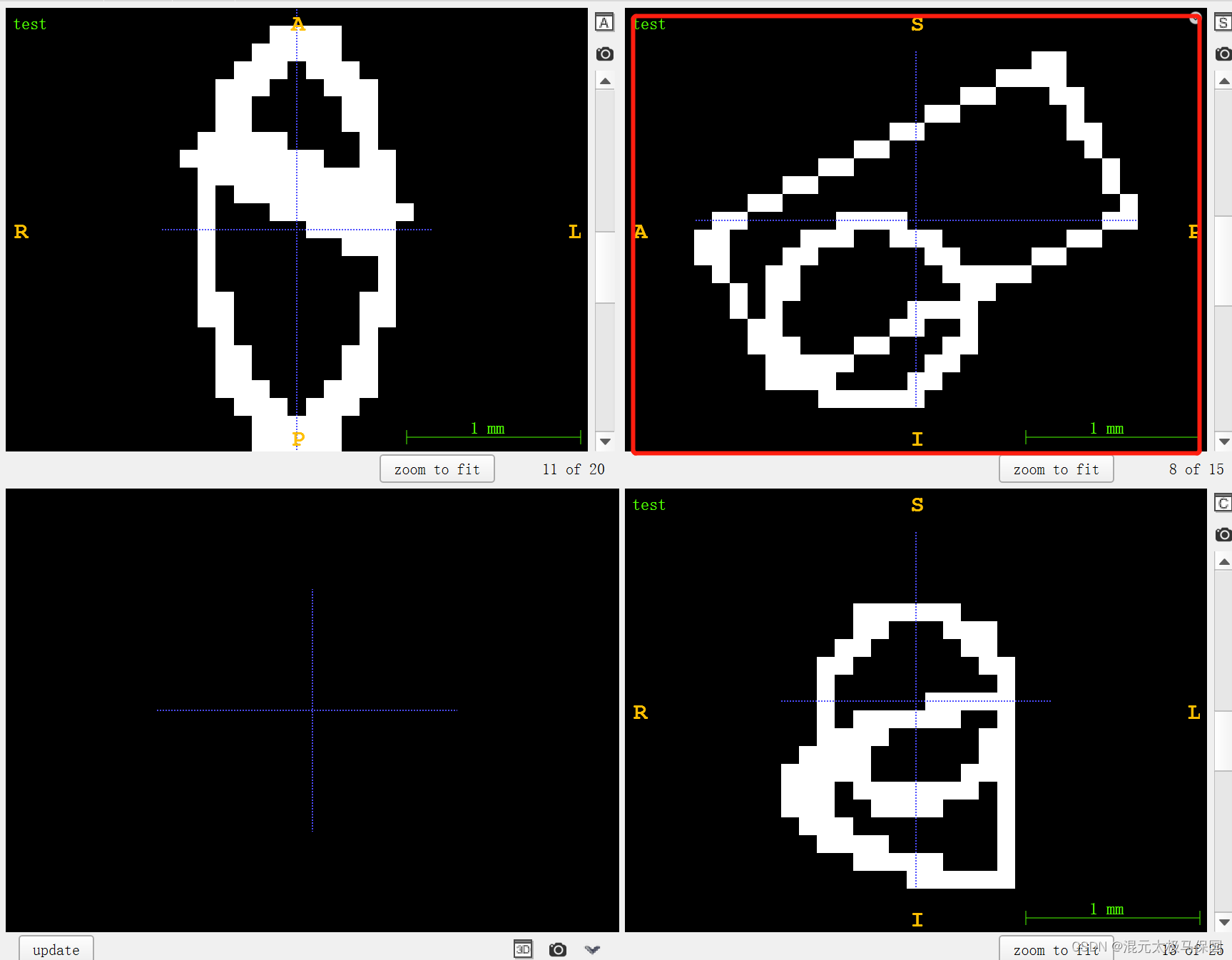 使用vtkImageStencil处理相交多边形出现空洞问题_vtkimagestenciltoimage-CSDN博客