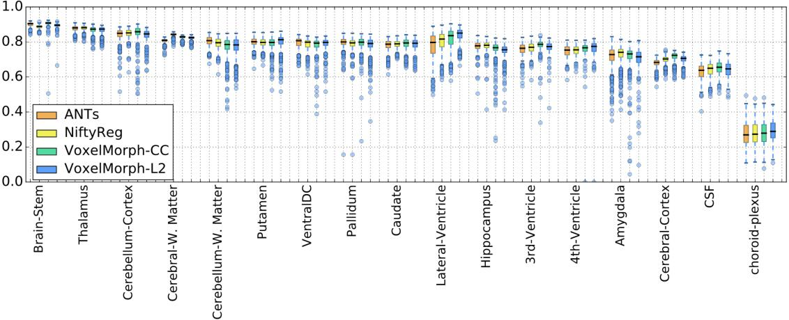 【转载】VoxelMorph 论文笔记-CSDN博客