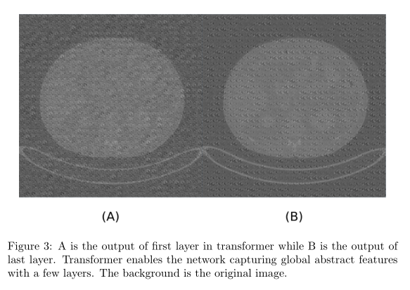 [Transformer]Transformer-Unet: Raw Image Processing with Unet_unet transformer-CSDN博客