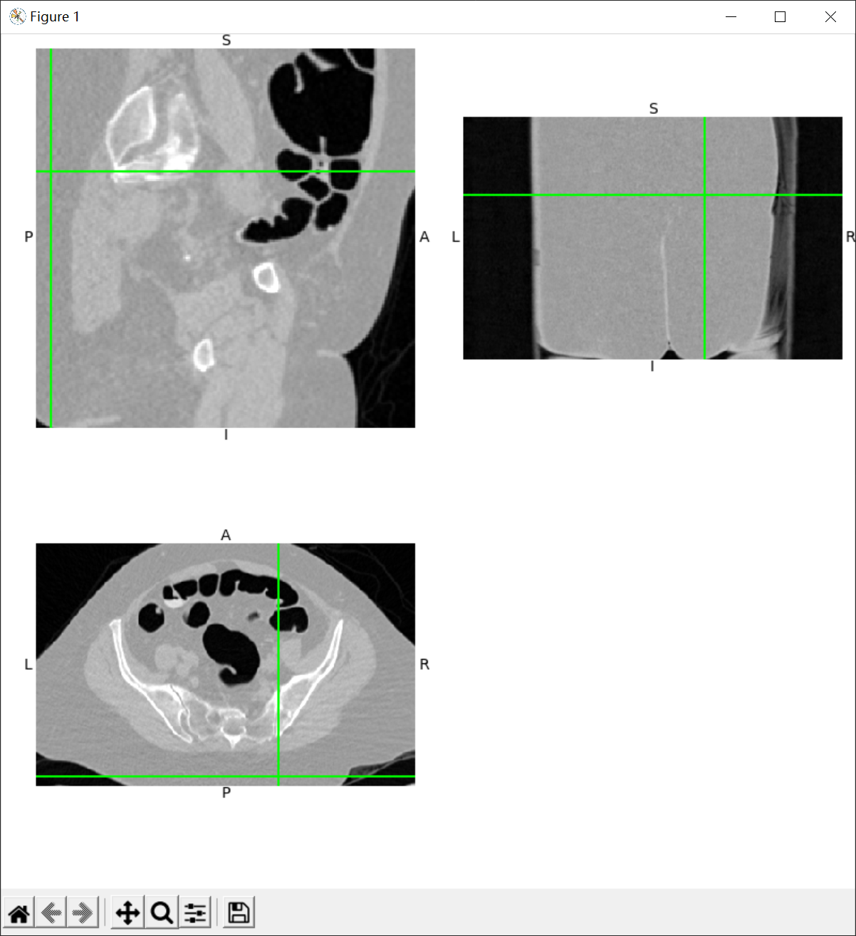 Medical Image Dicom (.dcm) is converted to Nifti (.nii) format - Programmer Sought