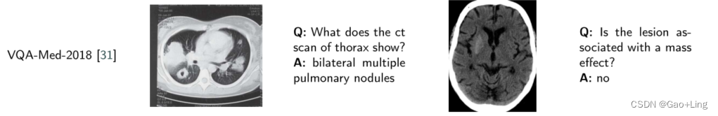 医学视VQA——综述_vqa-rad-CSDN博客