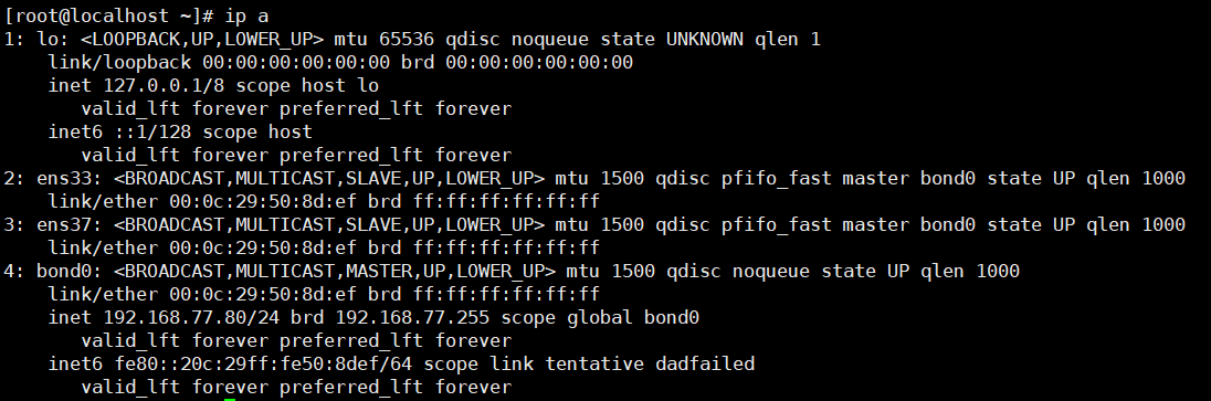 Linux学习之配置bond_服务器bond配置-CSDN博客