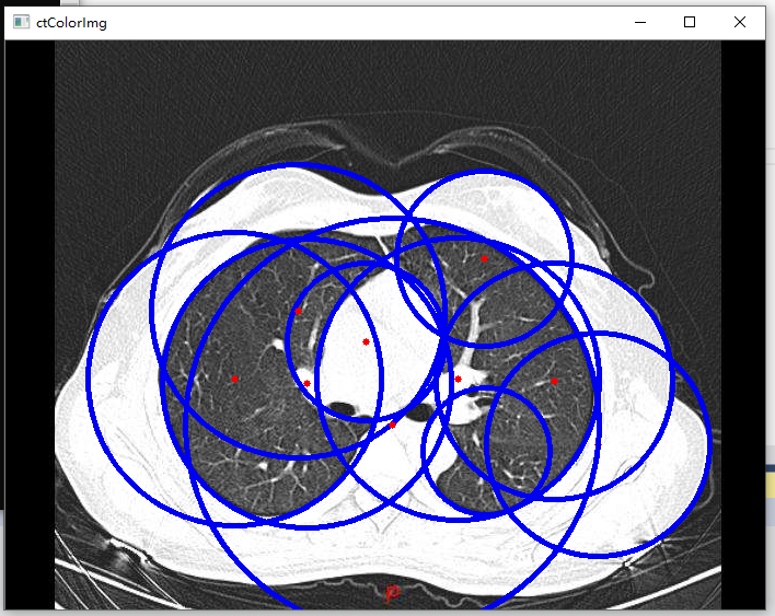 利用opencv的函数houghcircles实现霍夫梯度法圆检测时参数dp的值对于最终结果影响是挺大的houghcircles Dp Csdn博客