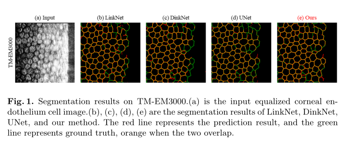 [Transformer]A Multi-Branch Hybrid Transformer Network for Corneal ...