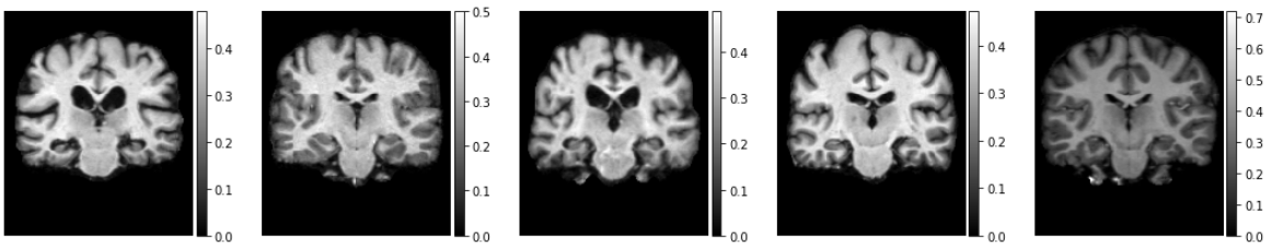 VoxelMorph-无监督医学图像配准-代码讲解-CSDN博客
