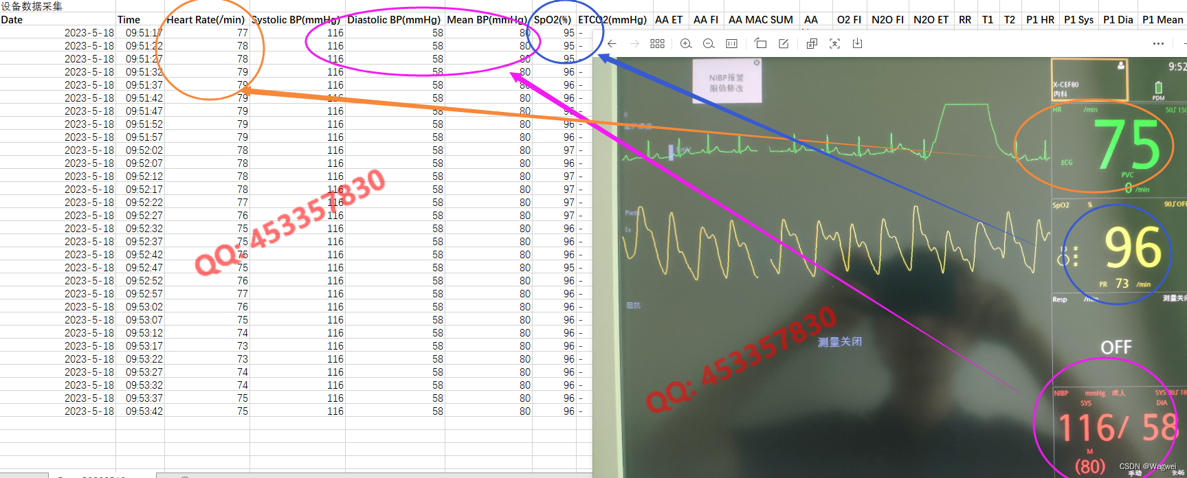 GE监护仪协议对接(B850、B650、B450、dash等)_ge dash 2500串口对接-CSDN博客