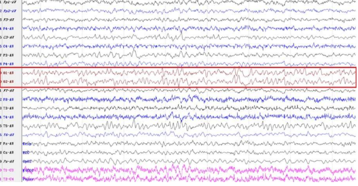 认知神经科学简介_intersubject correlation analysis (isc)-CSDN博客