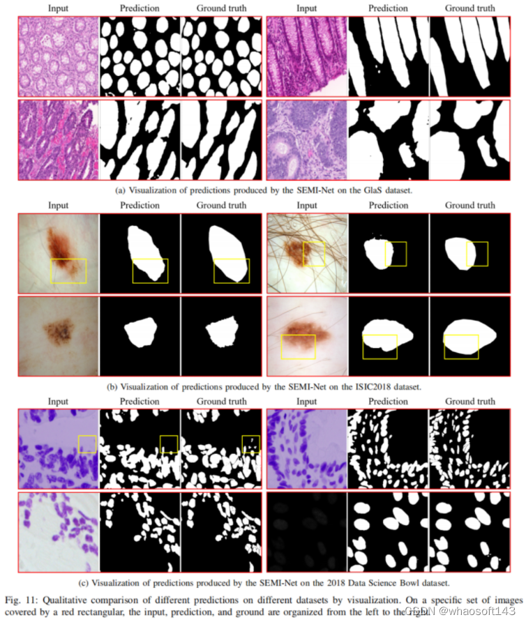 UNet-Transformer_transformer unet-CSDN博客