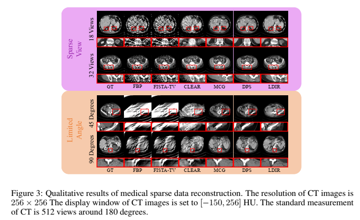 Iterative Reconstruction Based on Latent Diffusion Model for Sparse Data Reconstruction_扩散模型 ct ...