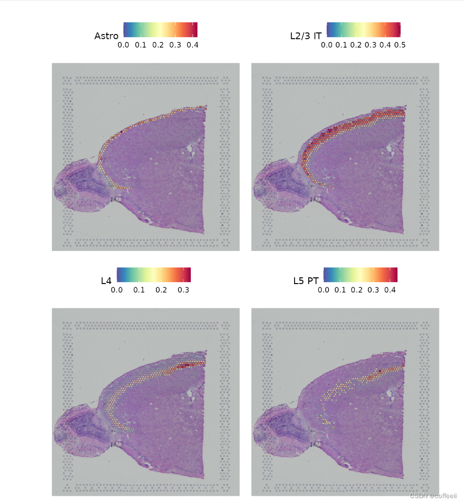 跟着Seurat官网学空间转录组（10X数据集为例，包含细胞映射，无监督学习）_seurat空间转录组-CSDN博客