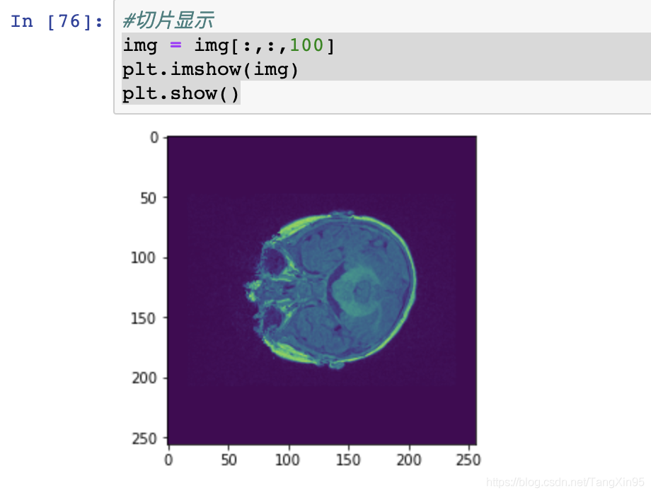 MRI预处理-去颅骨_python ct图像颅骨去除-CSDN博客
