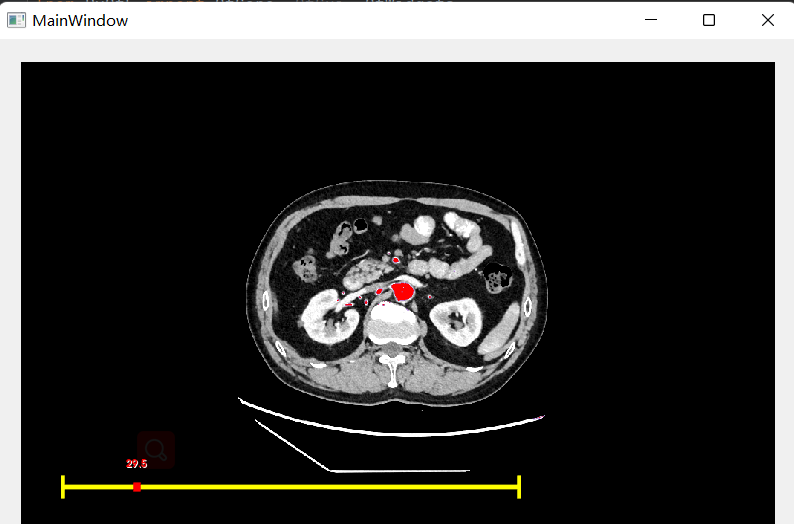 vtkImageViewer2的使用方法（原始灰度图像和分割后的彩色图像的叠加显示）_python vtkimageviewer2-CSDN博客