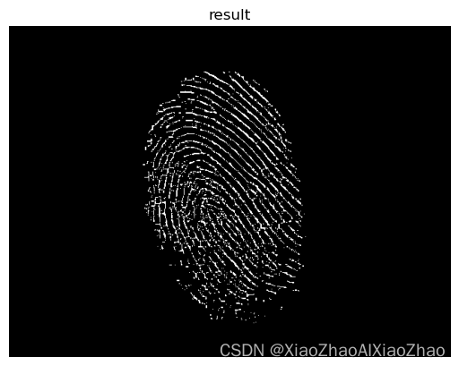 图像处理 形态学提取形态学骨架 Csdn博客 