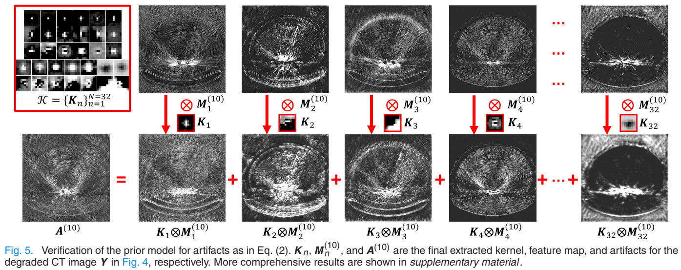 Deep Interpretable Convolutional Dictionary Network For Metal Artifact Reduction In Ct Images 卷积