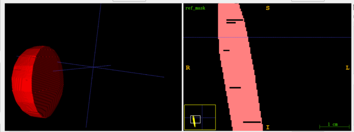 VTK笔记-使用vtkImageStencilData转换polygon时出现random bad lines-CSDN博客