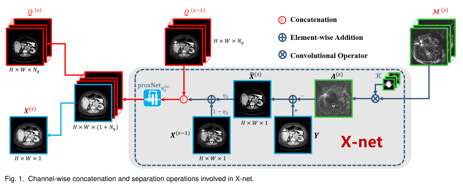 Deep Interpretable Convolutional Dictionary Network for Metal Artifact Reduction in CT Images_卷积 ...
