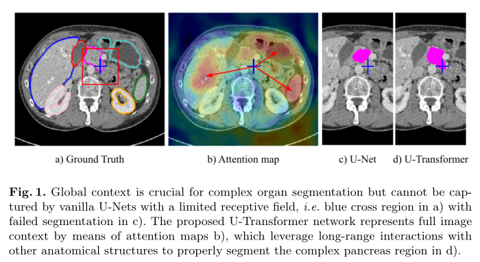 [Transformer]U-Net Transformer: Self and Cross Attention for Medical Image Segmentation_u ...