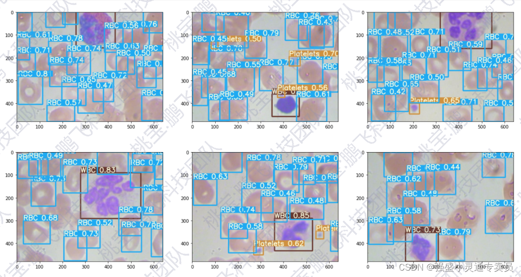 【YOLOv5】YOLOv5 物体检测血细胞计数和检测实现_yolov5训练bccd数据集-CSDN博客