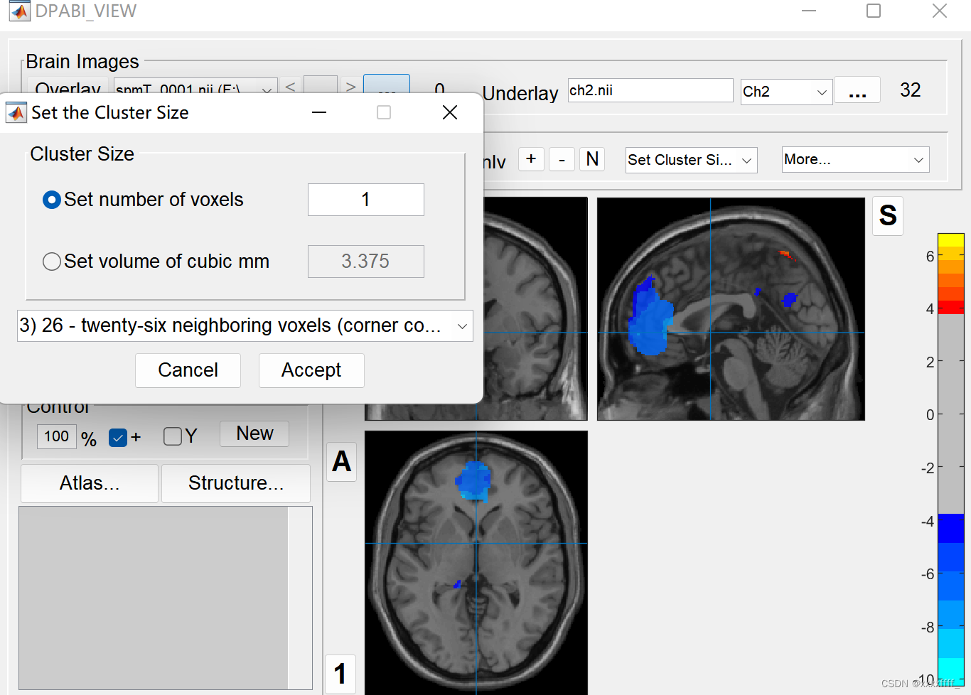 dpabi viewer使用-CSDN博客