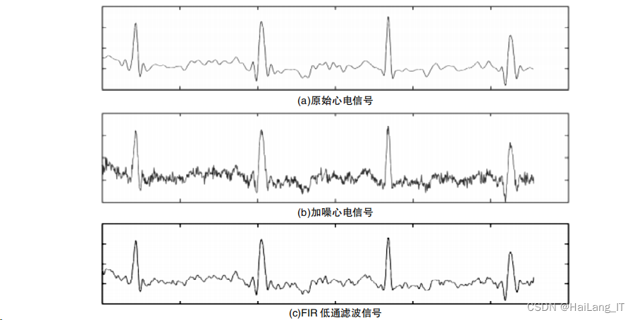 毕业设计 基于 Matlab 的心电信号去噪系统设计 Csdn博客