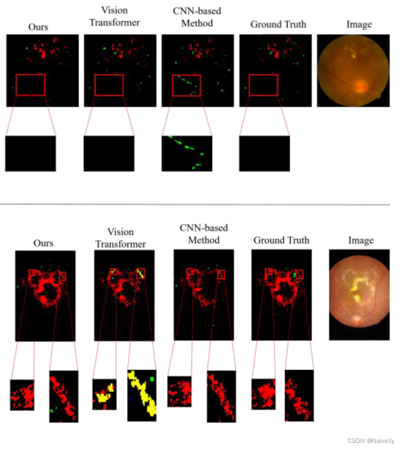 论文笔记TC-Net: A joint learning framework based on CNN and vision ...