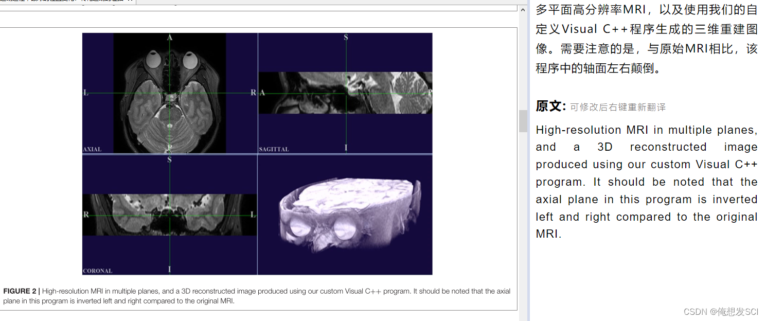 Positional Change of the Eyeball During Eye Movements: Evidence of ...