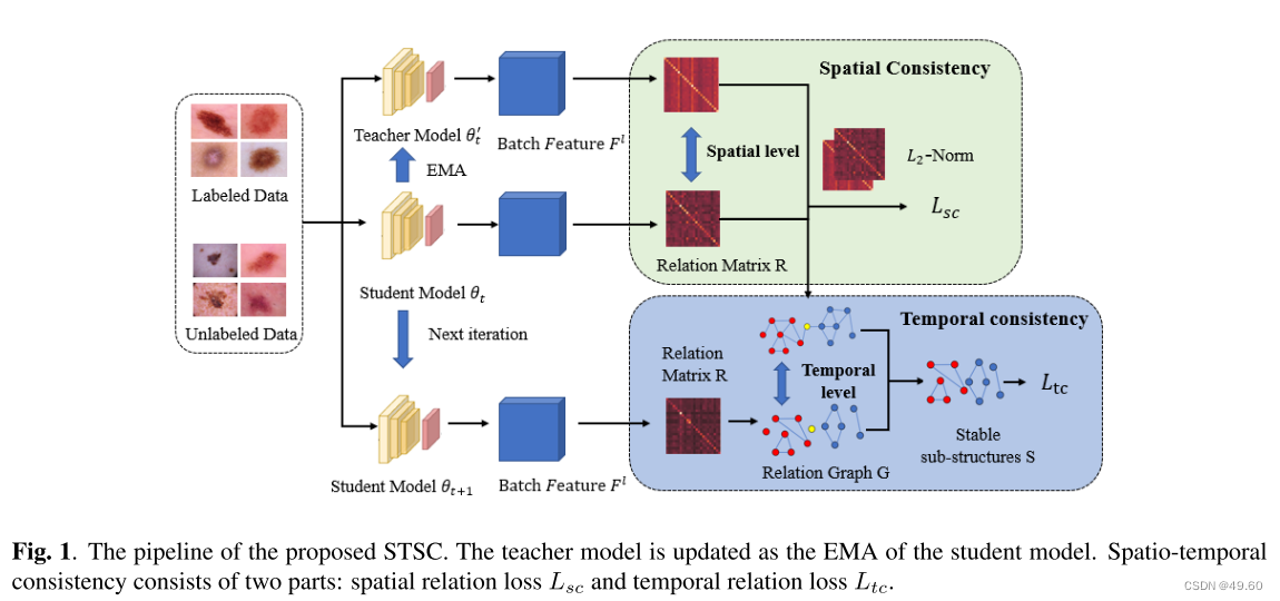 论文笔记：SPATIO-TEMPORAL STRUCTURE CONSISTENCY FOR SEMI-SUPERVISED MEDICAL ...