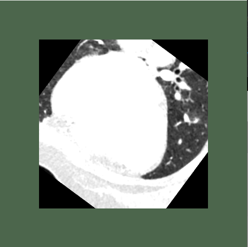 VTK笔记-计算MPR切面-vtkImageReslice输出视口设置-CSDN博客